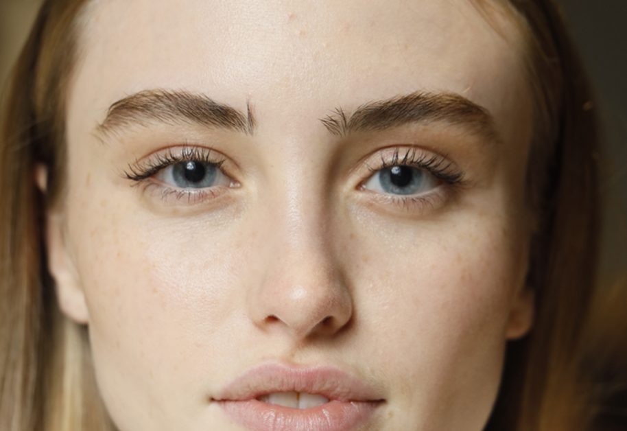 Brufoli: ecco perché compaiono anche durante questo periodo di ...